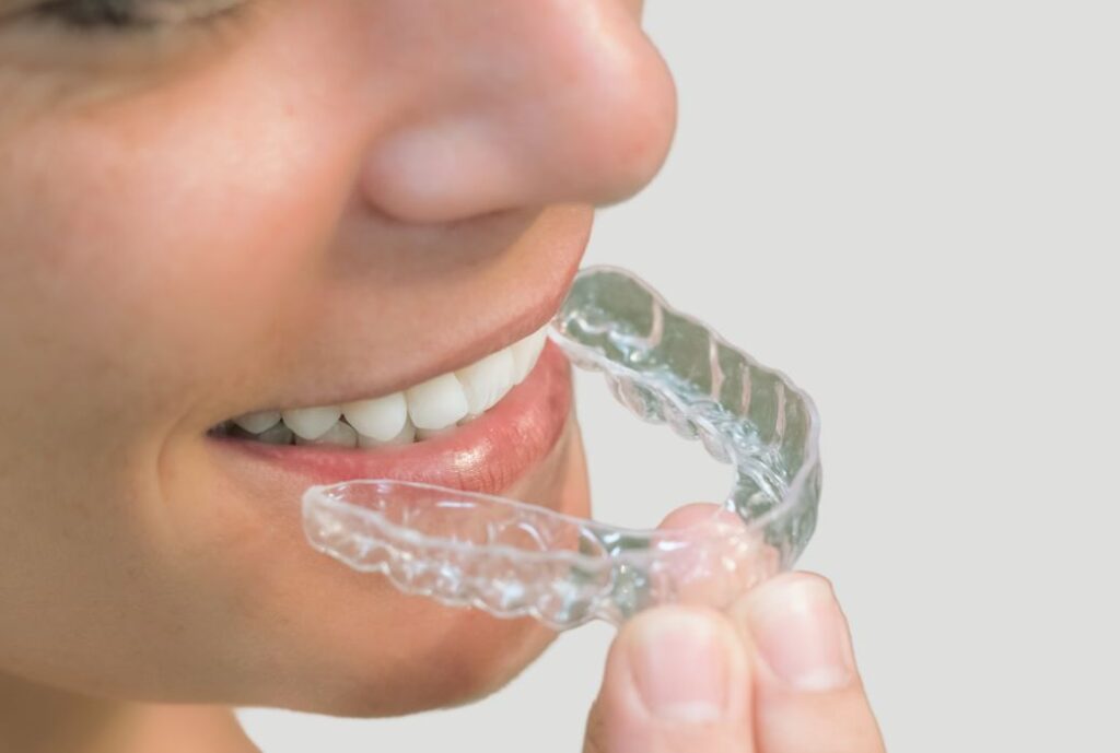 ORTODONCIA - Belgrano Studio Dental